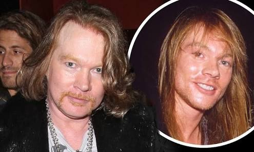 The Official Fat Axl Thread |﻿ Music, Musicians and Bands