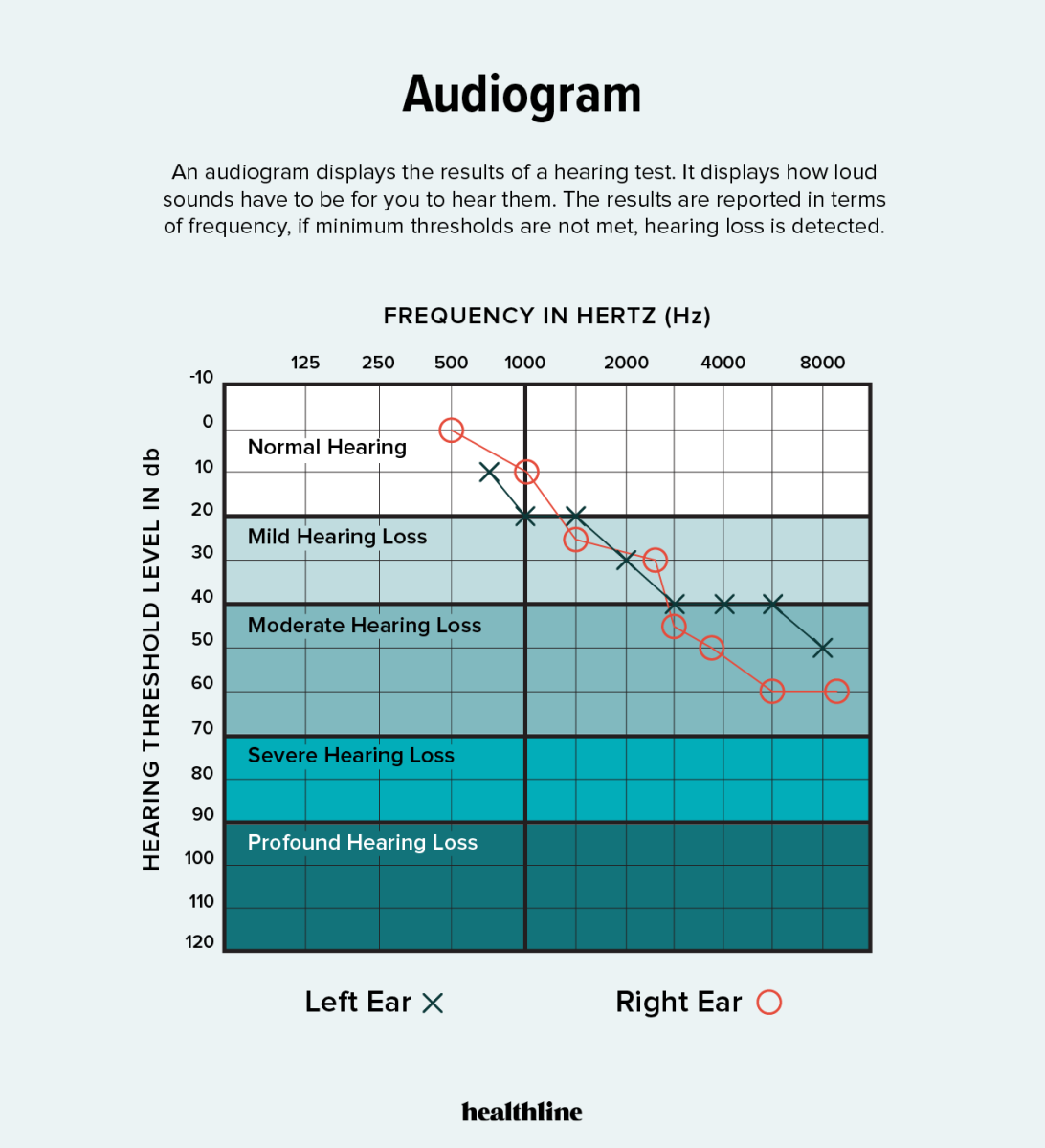 Can you hear anything above 44kHz? - Page 7 - Digital Sources, DACs ...